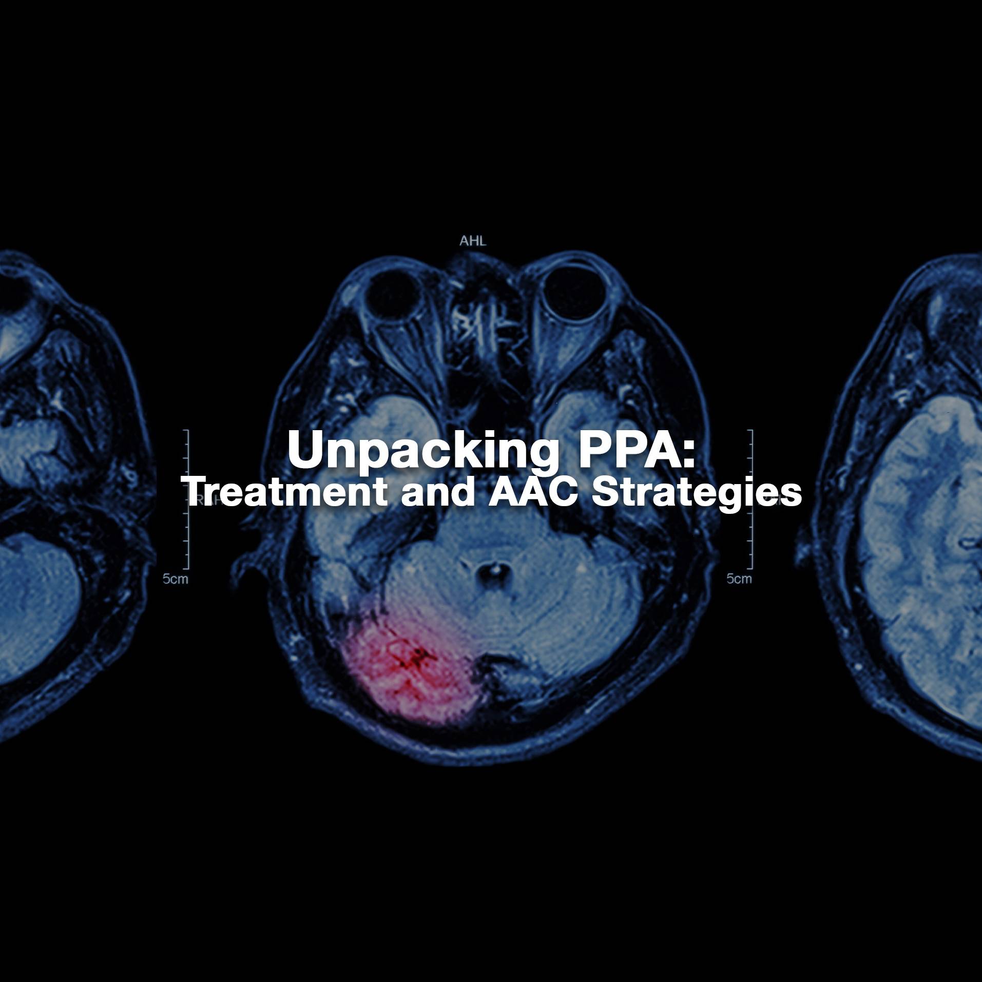 Unpacking PPA: Treatment and AAC Strategies